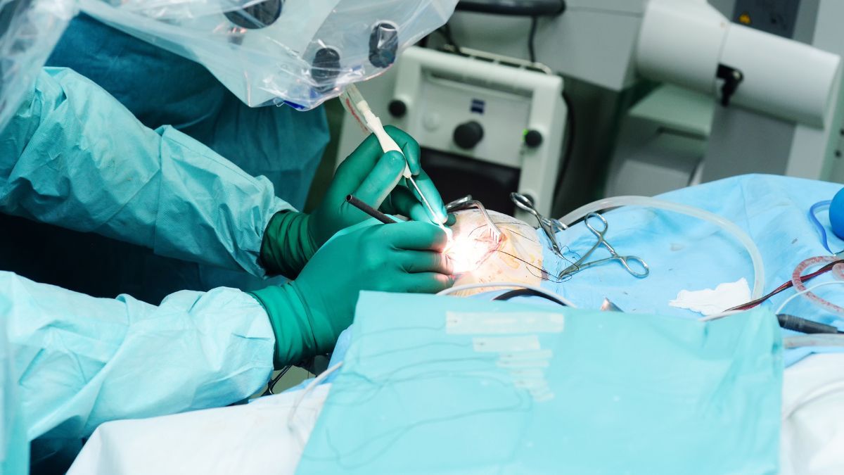 6 Jenis Operasi Tumor Otak dan Efek Sampingnya - KlikDokter